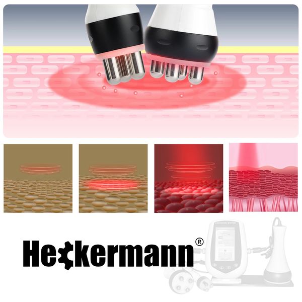 Urządzenie Do Liposukcji Ultradźwiękowej Heckermann Lw-127 - Arena.pl