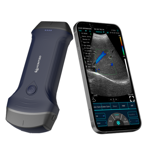 Kup Dwu-głowicowy Aparat USG 3w1 + kolor doppler WIFI USB (Wersja ...